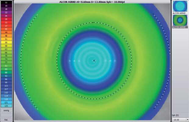 Корнеотопограф OCULUS Easygraph – Медична компанія Медікус